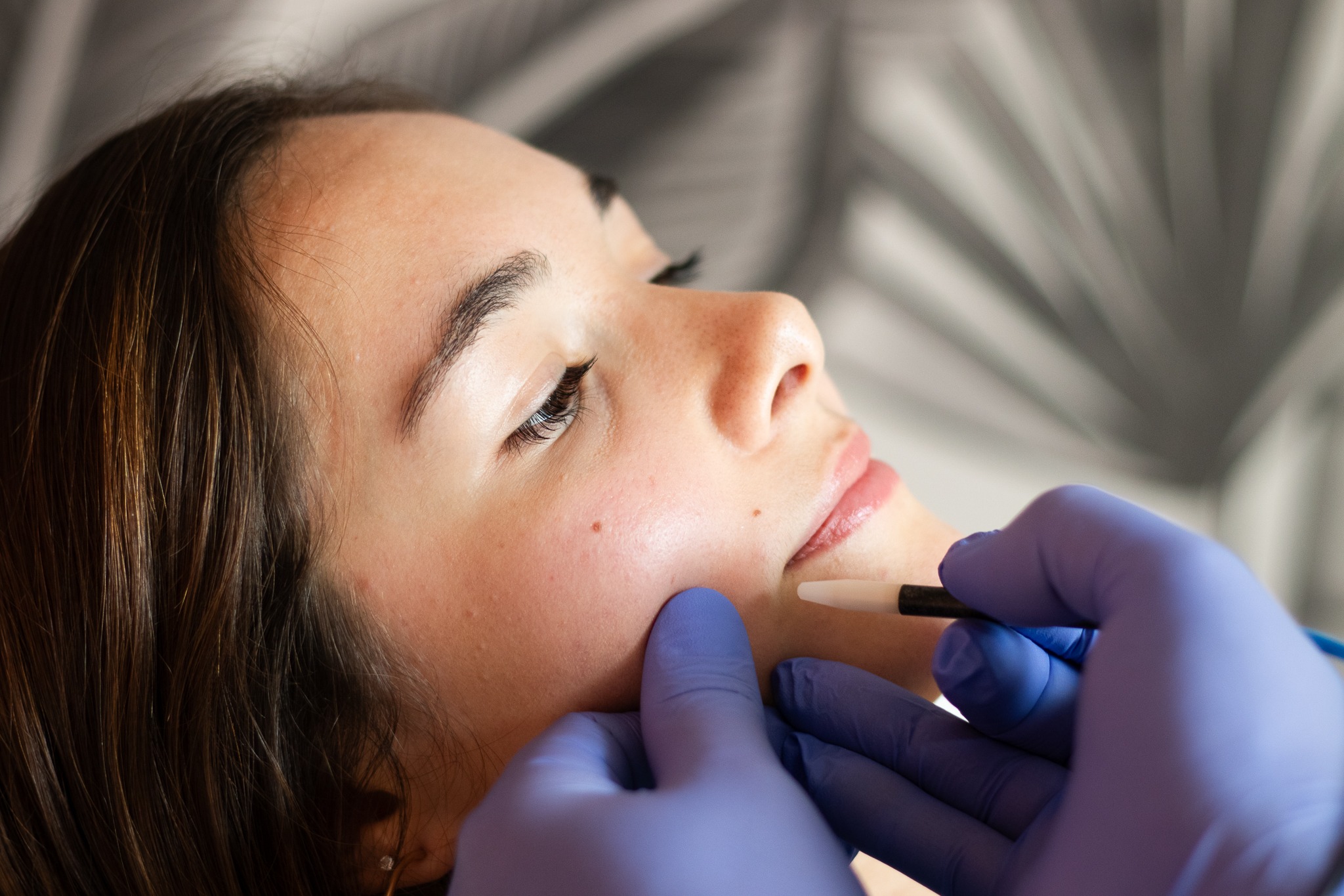 Épilation Électrolyse Définitive vs. Épilation Traditionnelle ...